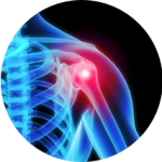 Platelet rich Plasma treatment Shoulder India | Ortho Biologic Surgery ...