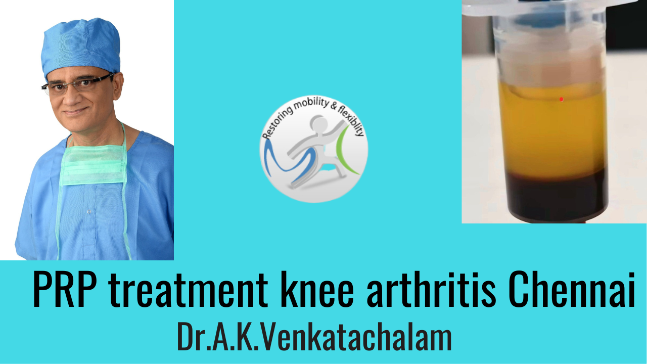PRP therapy knee arthritis Chennai