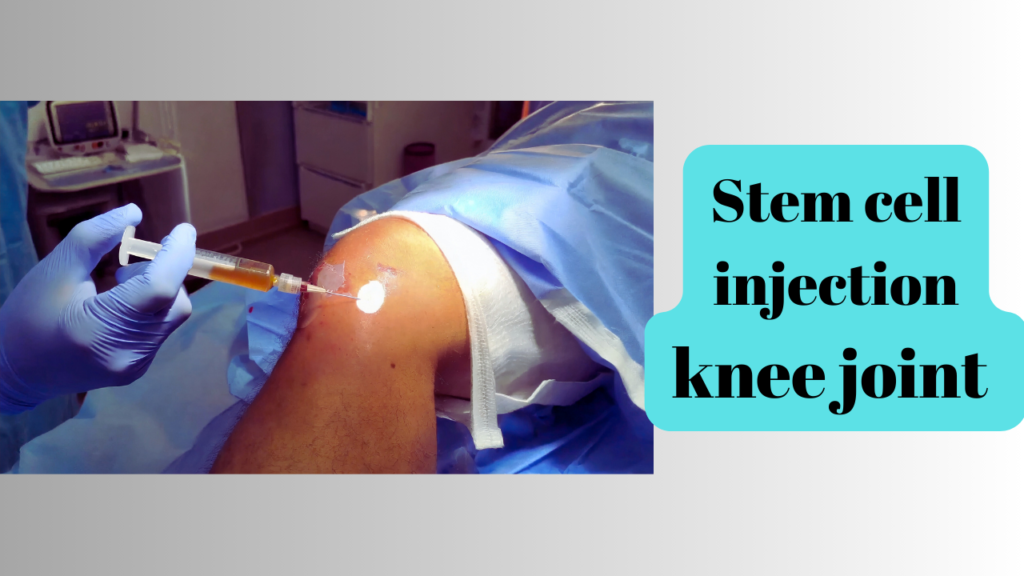 Stem cell injection knee joint | Ortho Biologic Surgery India